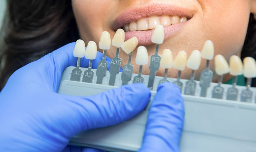 Different Types Of Teeth whitening Procedure Available In Boynton Beach